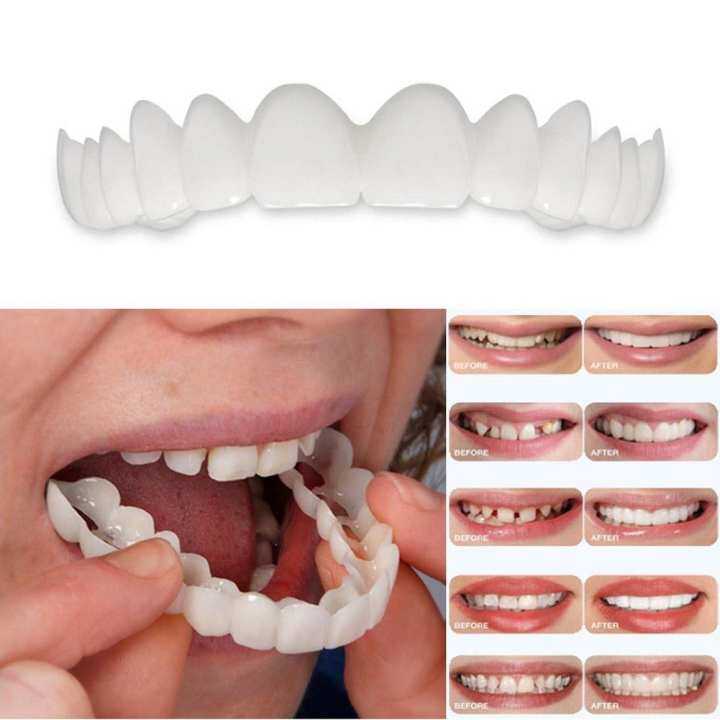 YBC Snap On Smile Teeth Comfortable Veneer Cover Smile Denture Fit Flex Cosmetic - tWyvIuiR ...