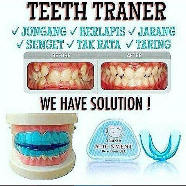 Teeth Trainer Alignment Orthodontic Tooth Trainer Tool Rapat Gigi Teeth ...