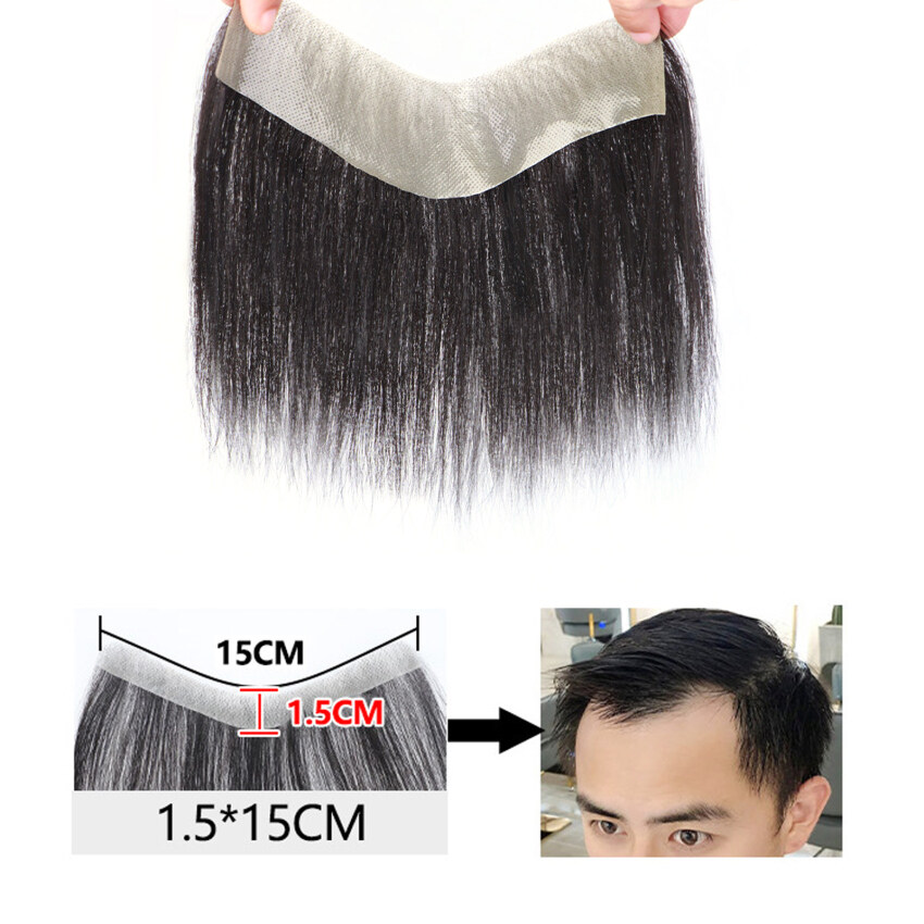 Hairline Wig Stickers Men'S Forehead Seamless Replacement Piece ...