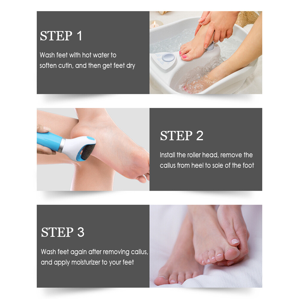 Electric Foot Grinder with Roller Head Battery Powered Portable Feet ...
