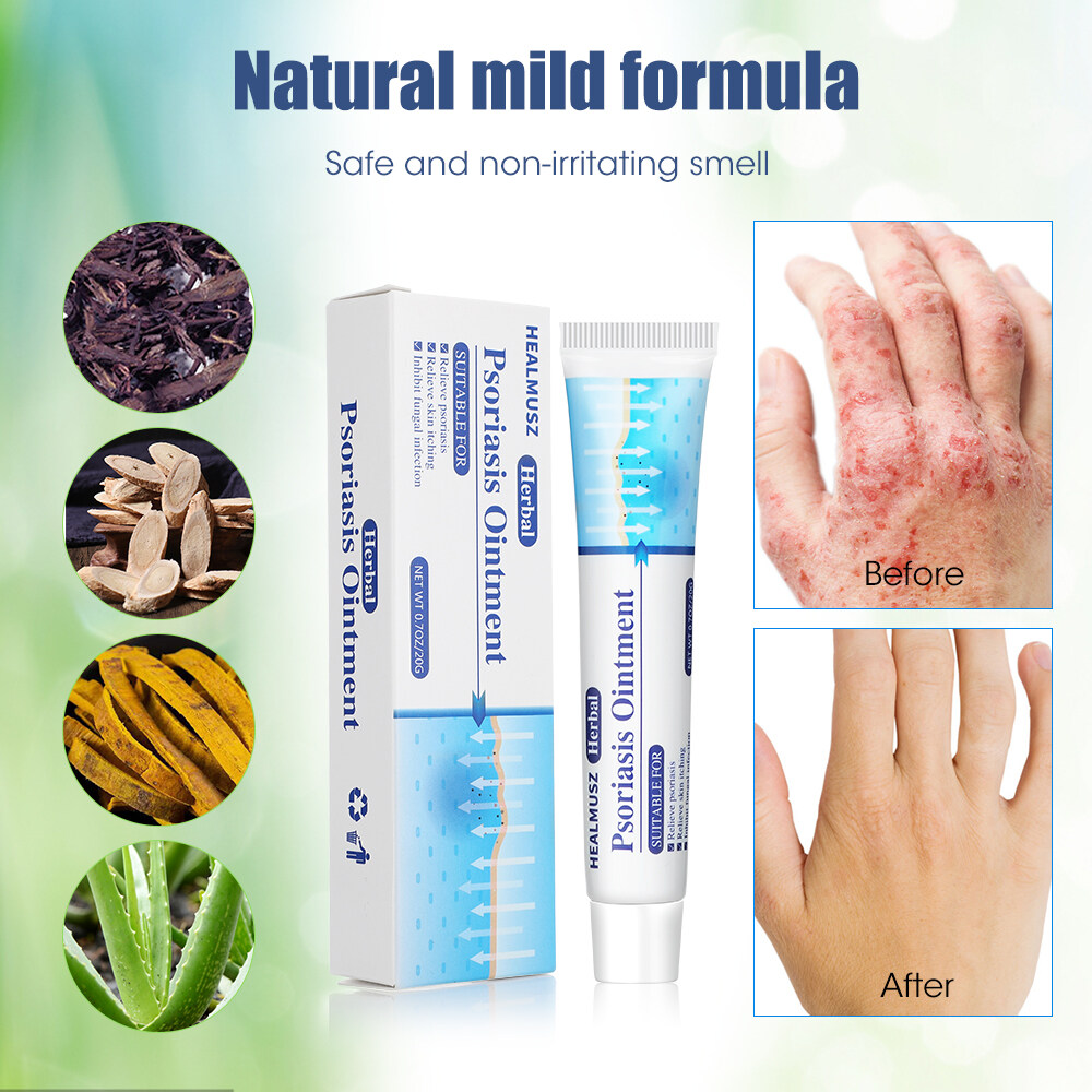 Psoriasis Antibacterial Ointment Topical Skin Ointment Inhibit Bacteria ...