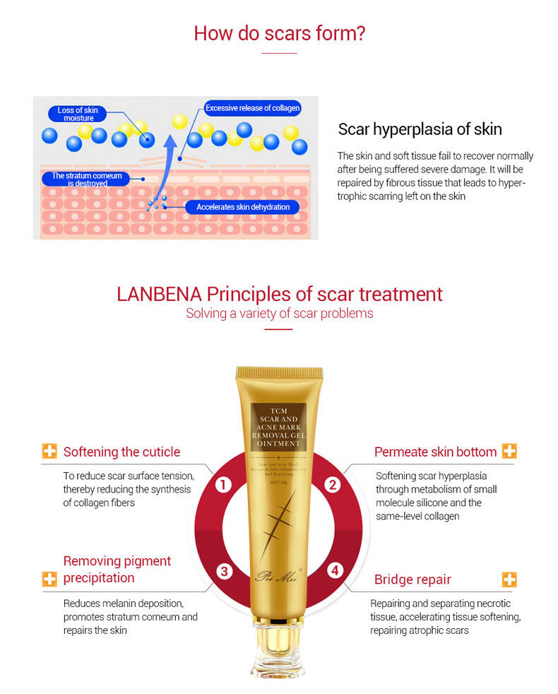 LADES【Ready In Stock】30Ml Women TCM Scar Cream Scald Surgical Scar ...