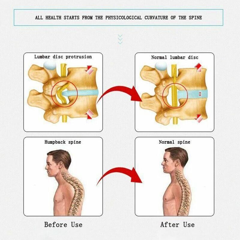 Koiut 【Ready!】Back Massager Orthosis Stretcher อุปกรณ์นวดฟิตเนส Relief ...