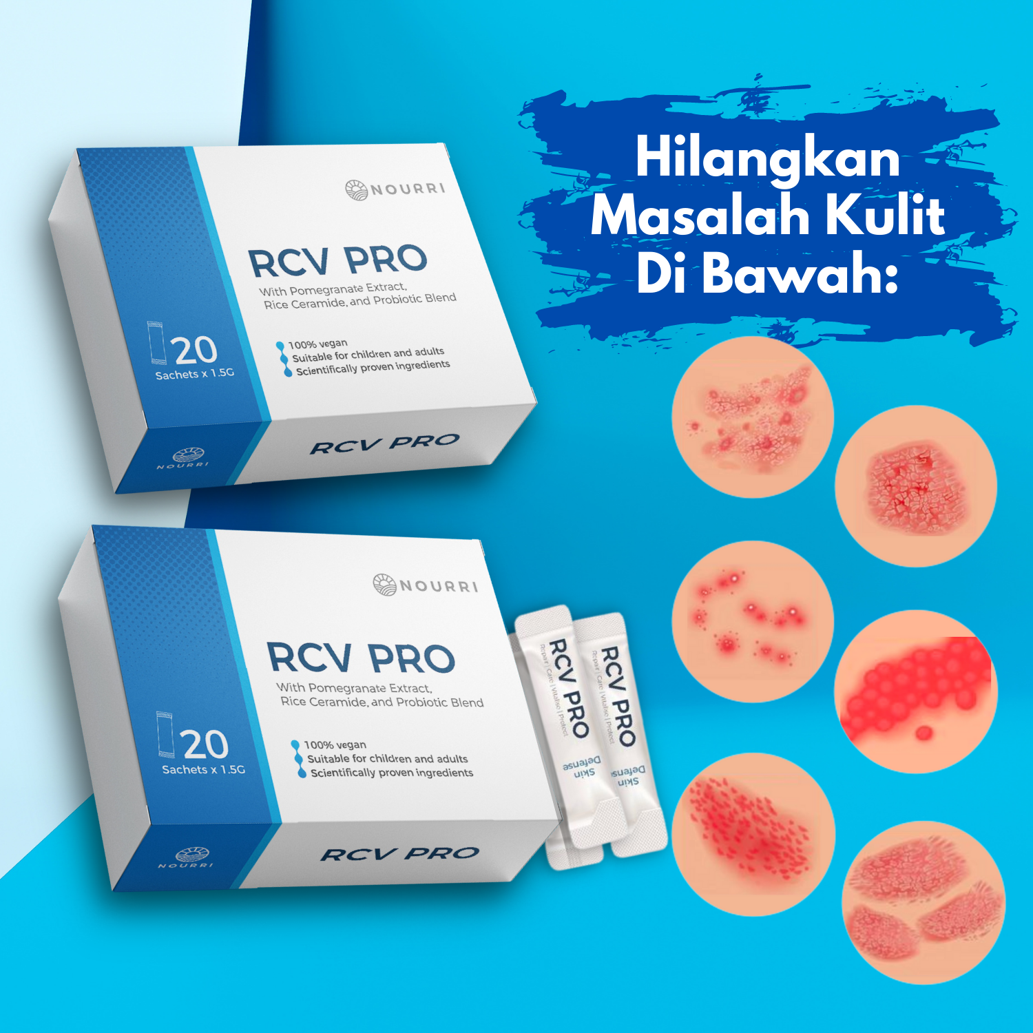 Nourri - RCV PRO – Intensive Pack 2 Boxes | Lazada
