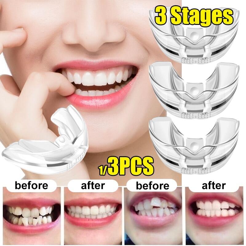 Orthodontic 3pcs/set Tooth Trainer Dental Tooth Appliance Alignment ...