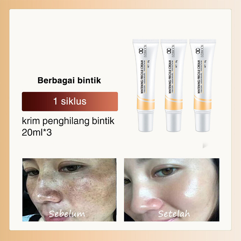Whitening and Spot Removing Cream Freckle removing cream 祛斑黄褐斑霜 20g ...