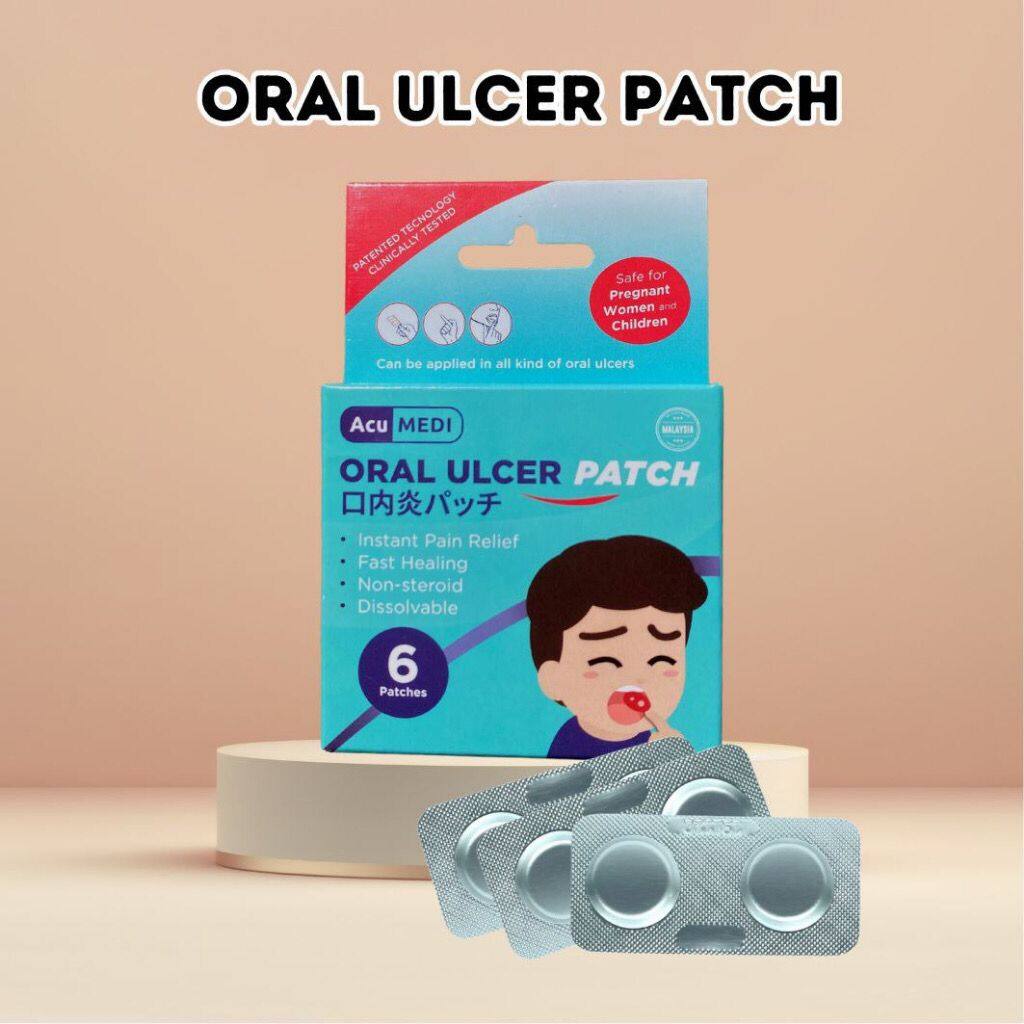 Pelekat Ulser Mulut Oral Ulcer Patch 口腔溃烂，口腔炎 贴 | Lazada