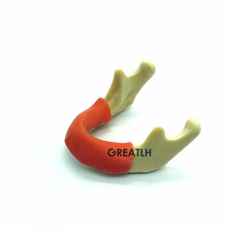 Mandible Jaw With Soft Tissue With Gum Implant Practise Teeth Model For ...