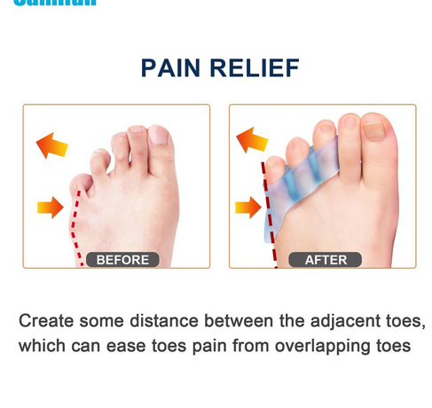 Three hole small toe separation orthosis small toe overlap orthosis ...