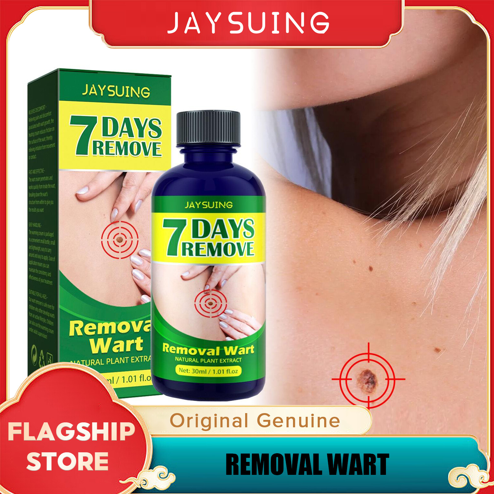 Jaysuing Skin Tag Remover Painless Mole Skin Dark Spot Wart Removal ...