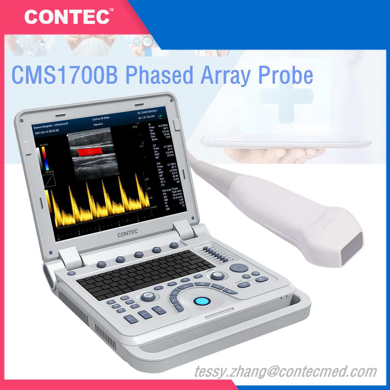 CONTEC CMS1700B Color Doppler Ultrasonic Diagnostic CF Cardiac ...