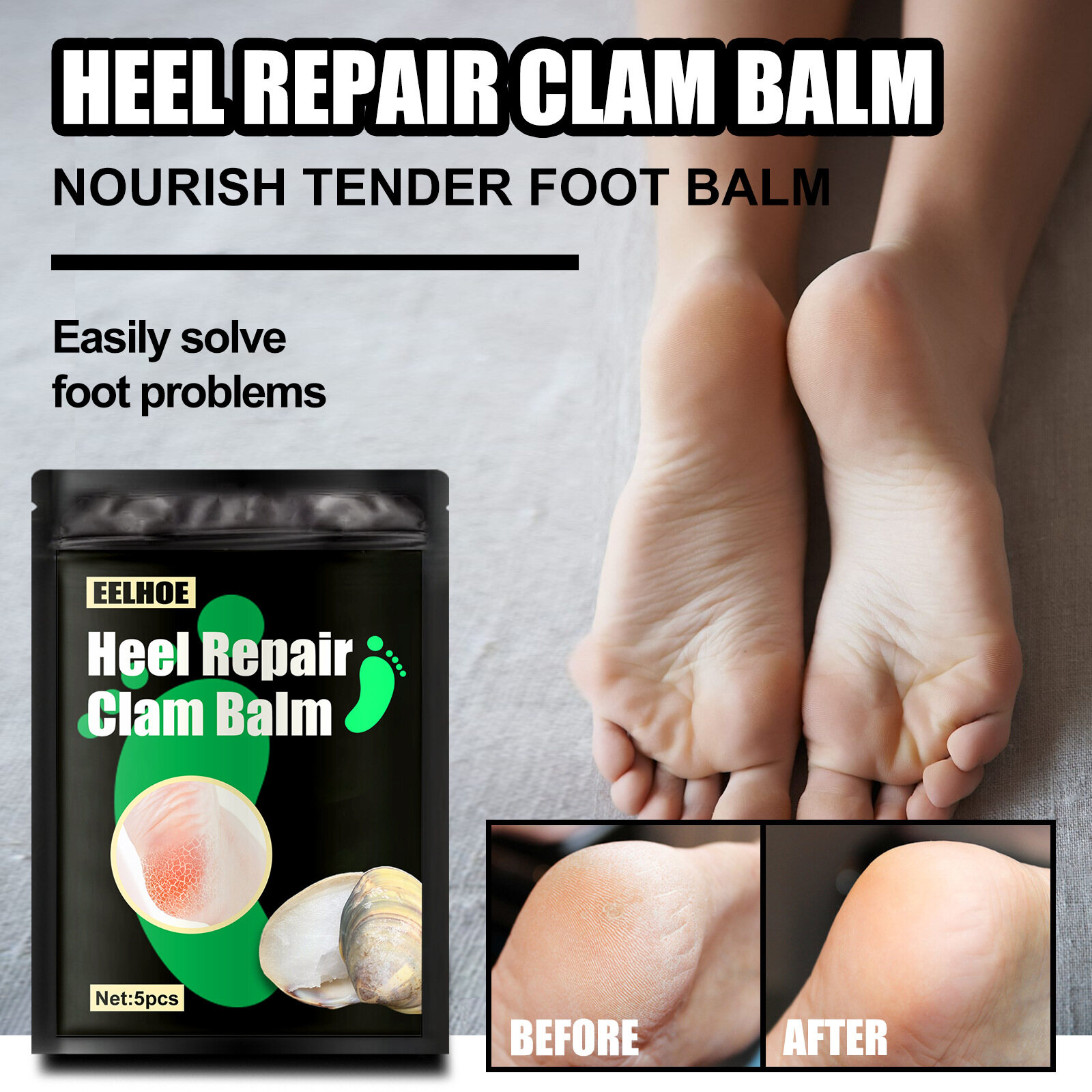 Eelhoe Heel Repair Clam Balm Heel Chapped Peeling Removal Dead Skin ...