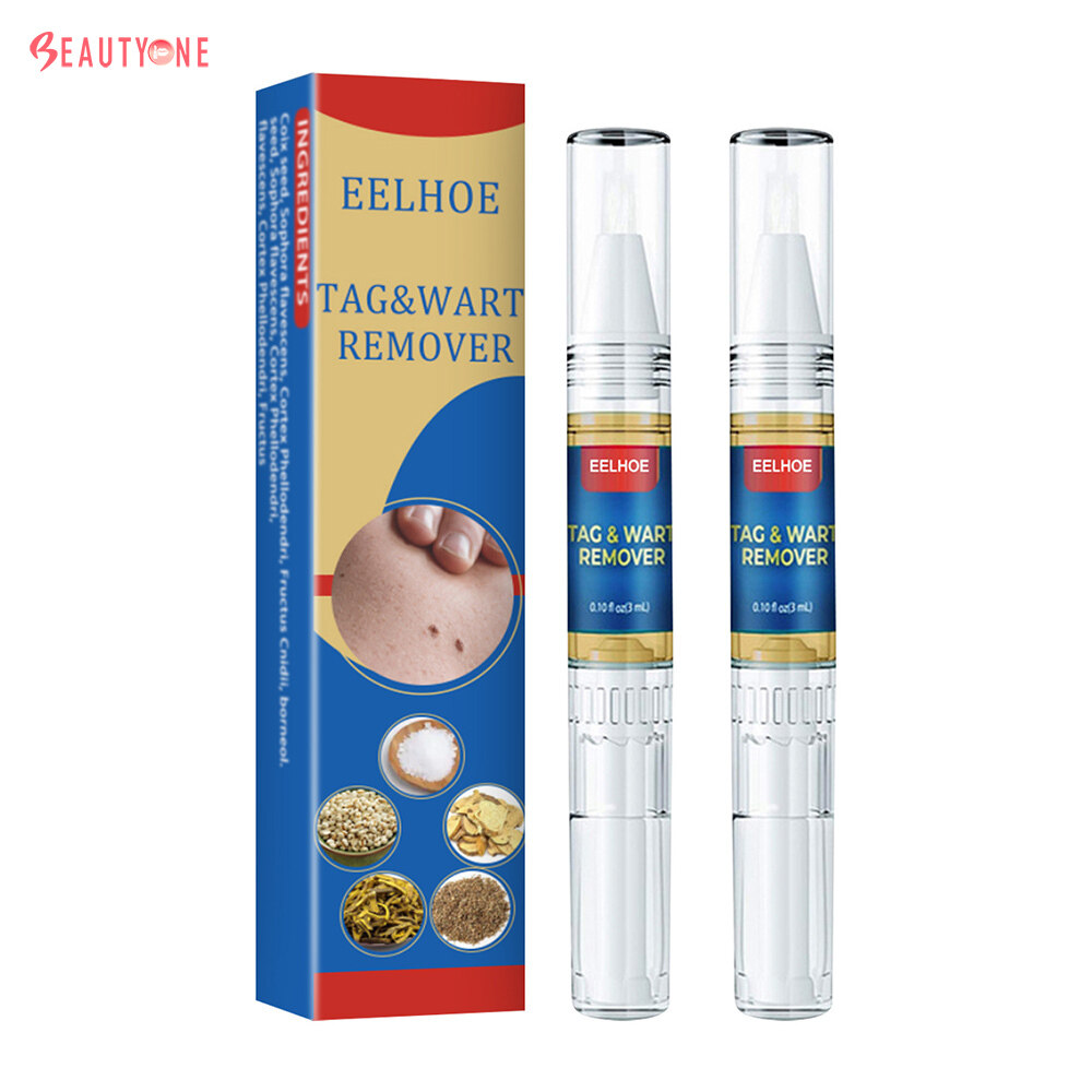 Warts Remover Original Kasoy Oil Warts Remover Warts And Skin Tags ...