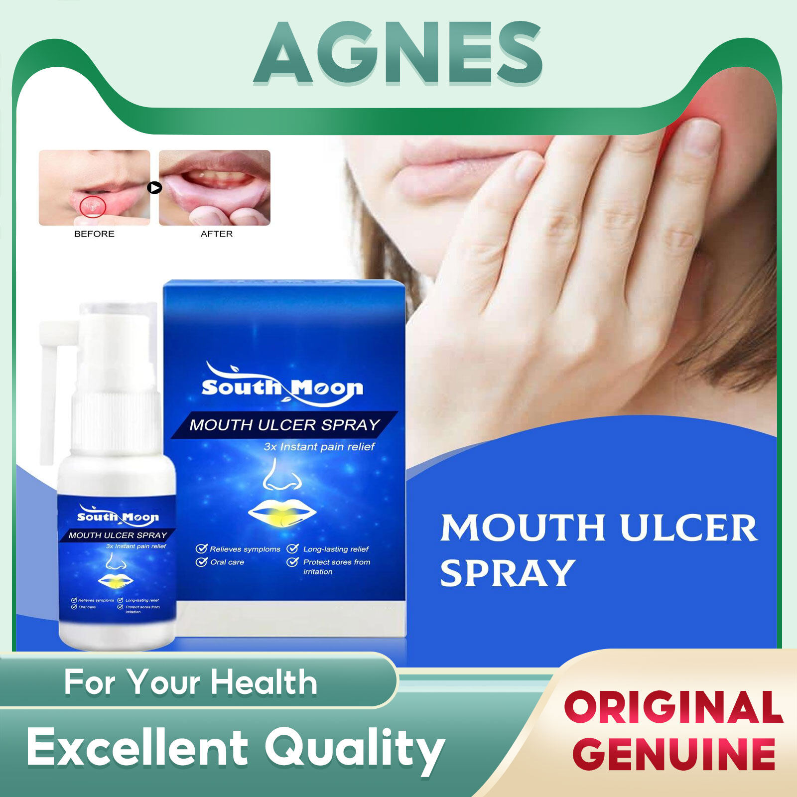 South Moon Mouth Clean Oral Spray Treatment Of Oral Ulcer Inflammation ...
