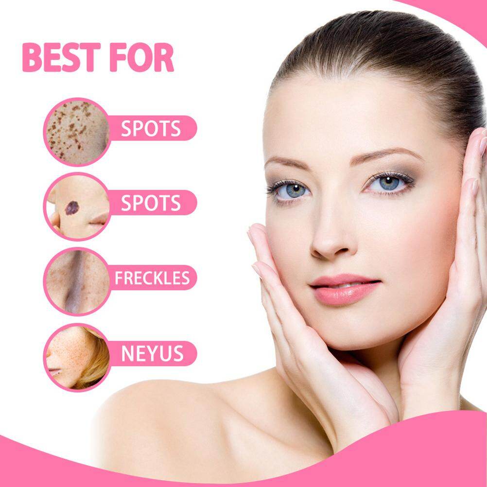 Moles Removal Mole Corrector Skin Spot Remover Skin Spot Purifying ...