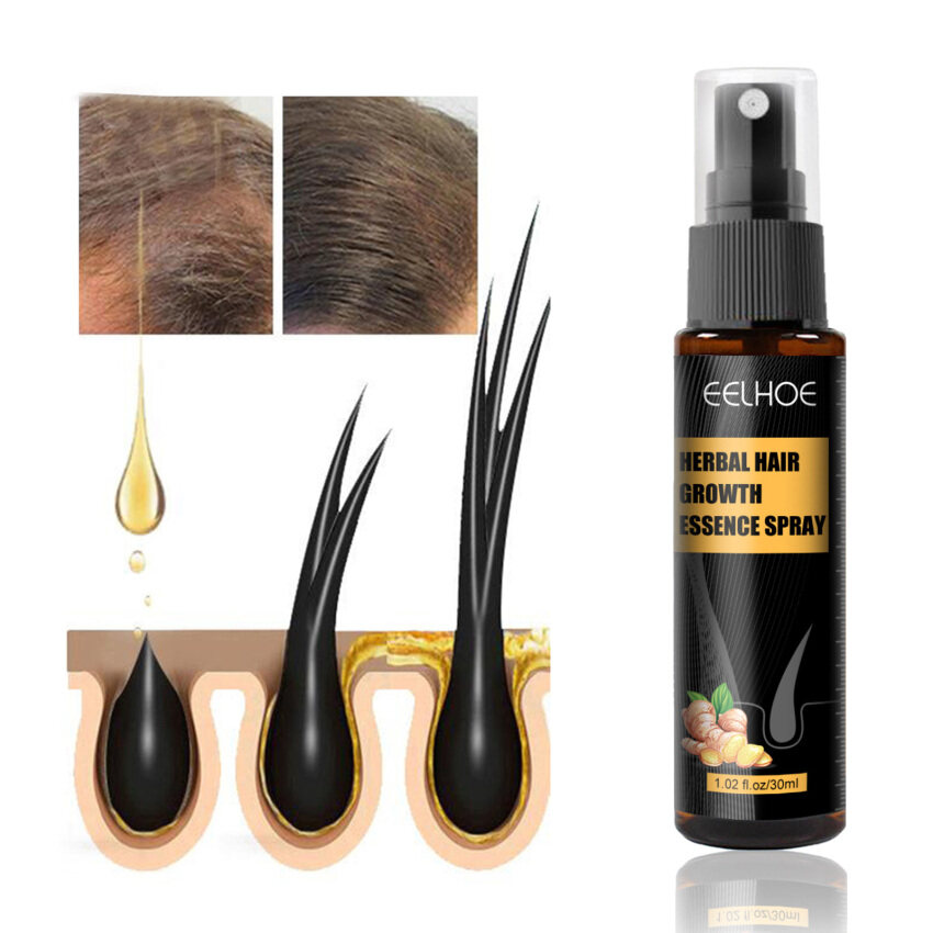 30ml Herbal Hair Growth Essence Spray Set Hair Loss Treatment ...