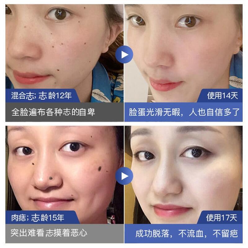 Painless Effective Products Care Face Set Serum Repair Cream Remover ...