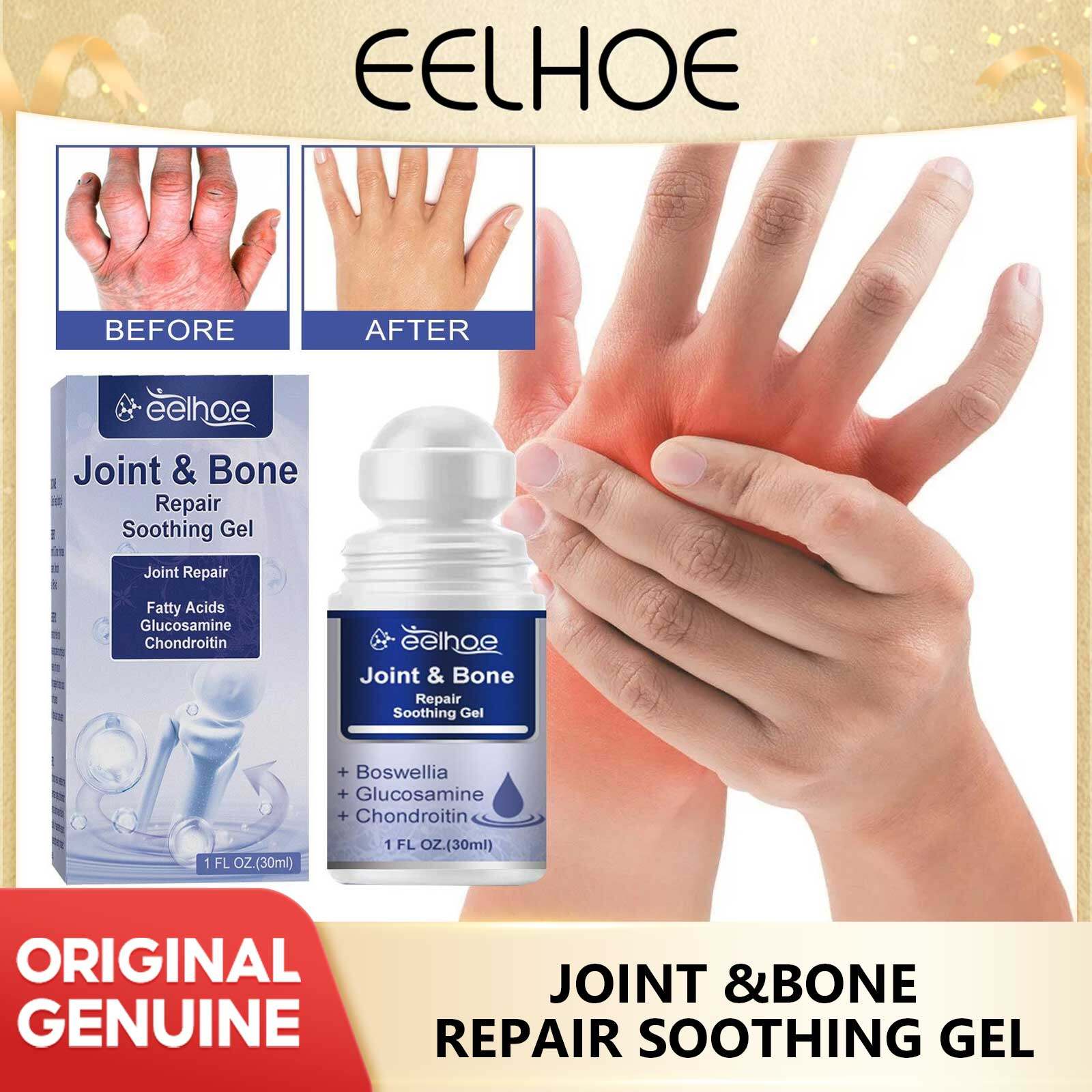 Eelhoe Joint Pain Care Gel Rheumatoid Arthritis Treatment Neuralgia ...