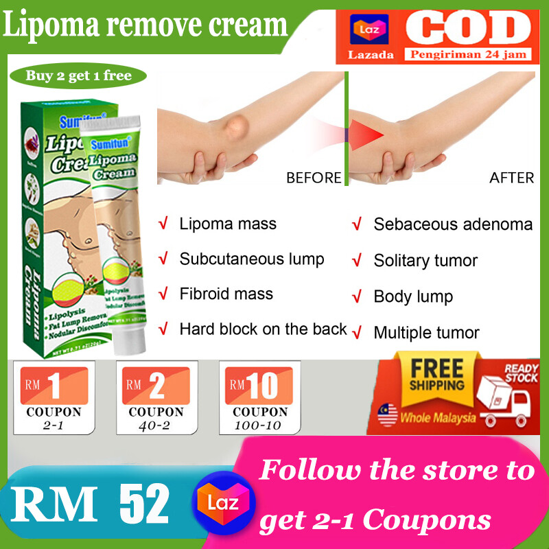 lipoma cream original lipoma removal cream 20g 脂肪瘤 ubat benjolan lipoma ...