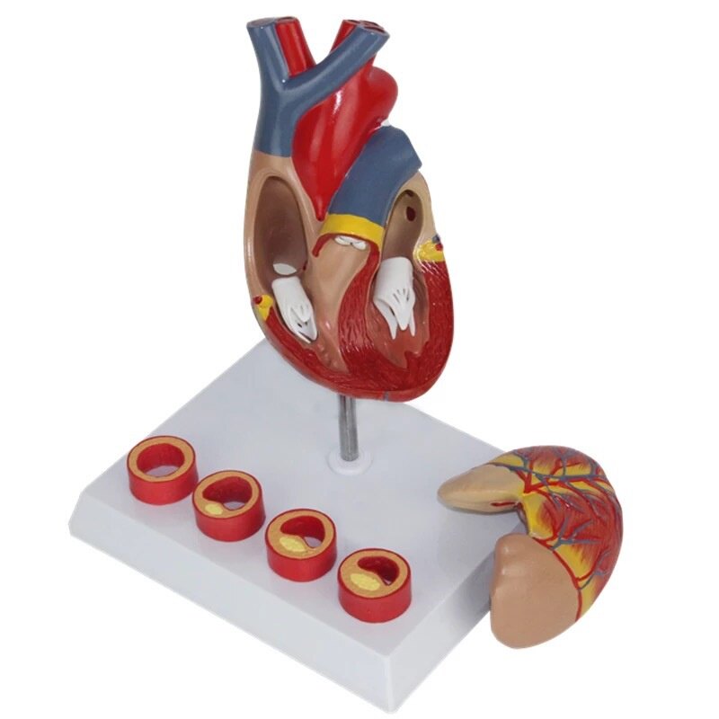 1:1 Life Size Human Heart Anatomy Model with 4 Stage Vascular Mounted ...