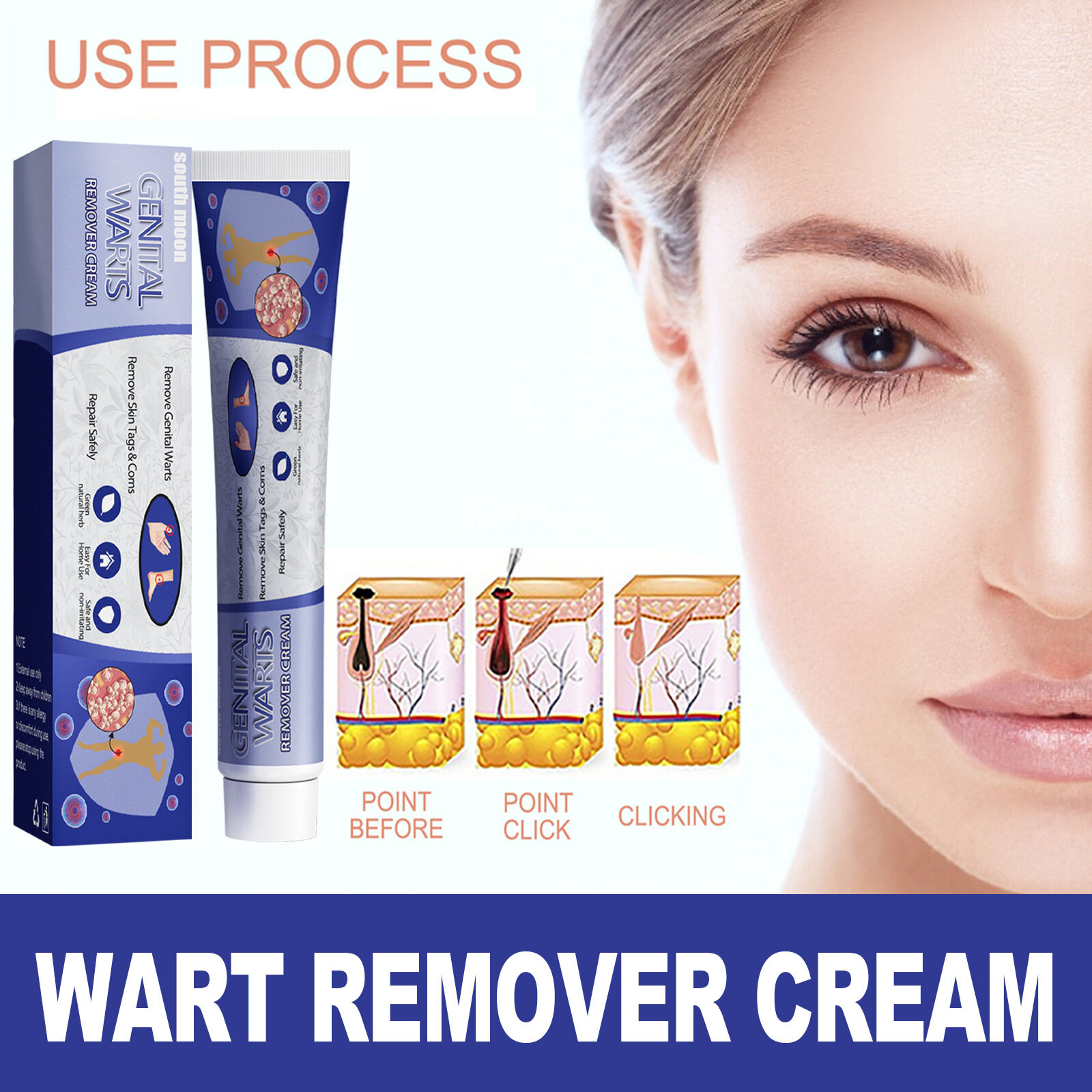 South Moon Wart Remover Original Cream Painless Wart Treatment Cream ...