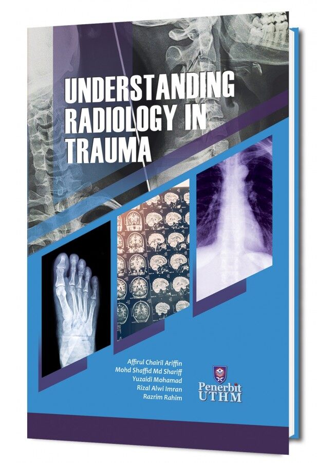Understanding Radiology In Trauma | Lazada