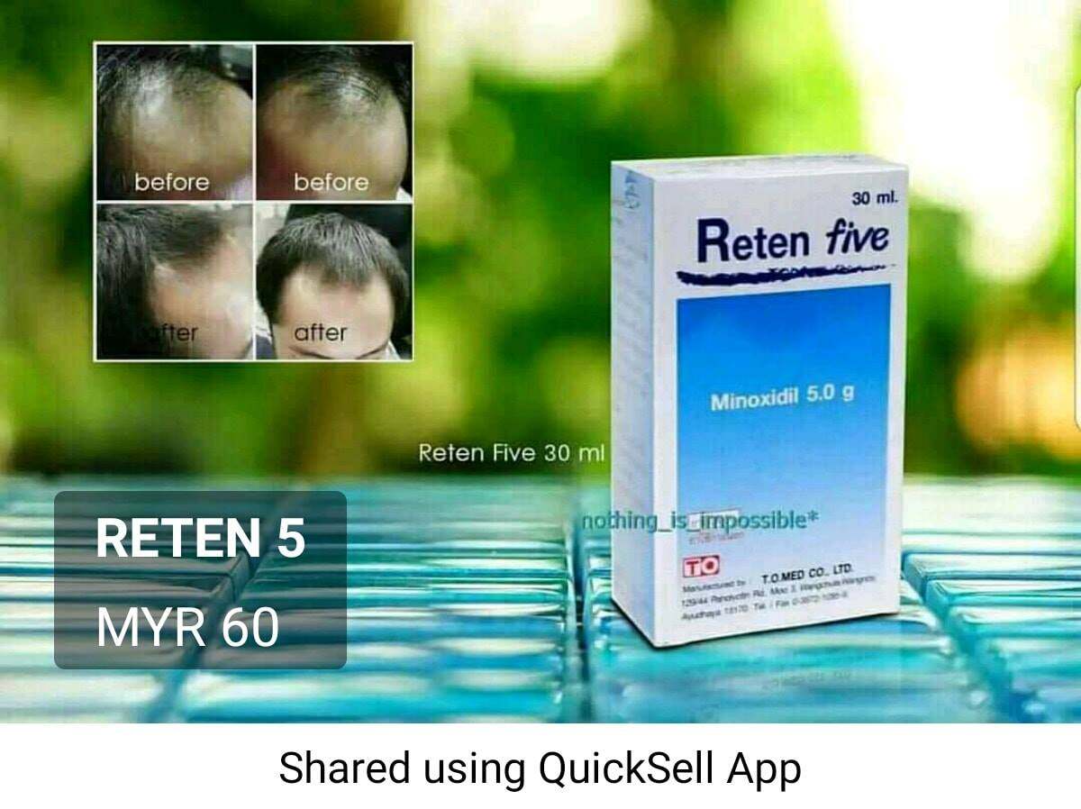 Reten Five Hair Tonic~result In A Week Lazada
