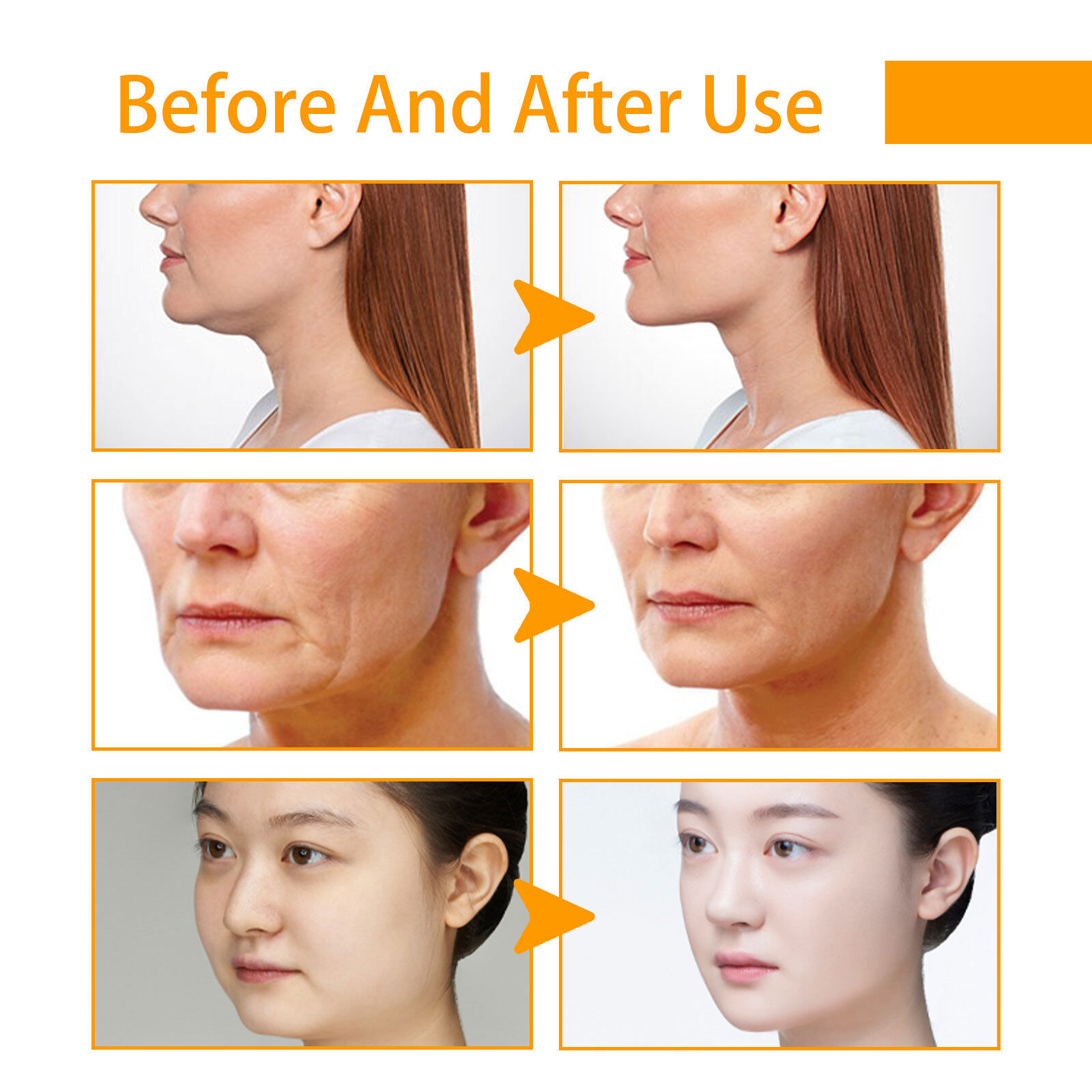 Jaysuing Turmeric Face Whitening Cream For Dark Skin Remove Acne ...