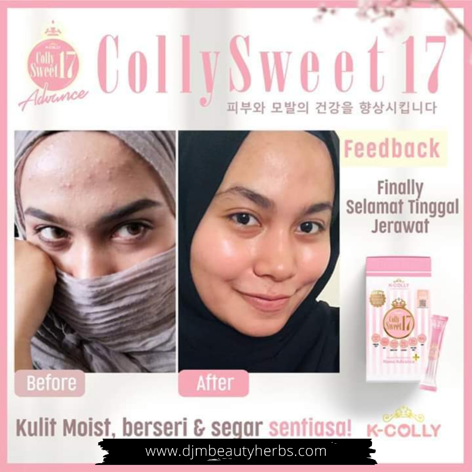 K-COLLY SWEET 17 TRIAL 20 SACHET | Lazada