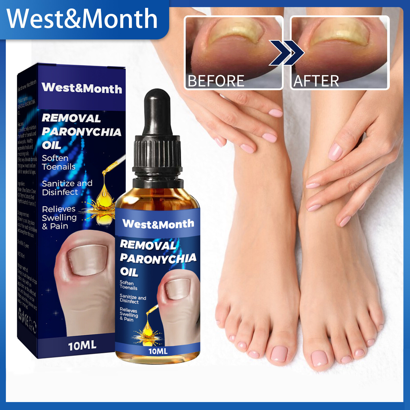 West Month Paronychia Treatment Oil Soften Toenails Disinfect Relieves ...
