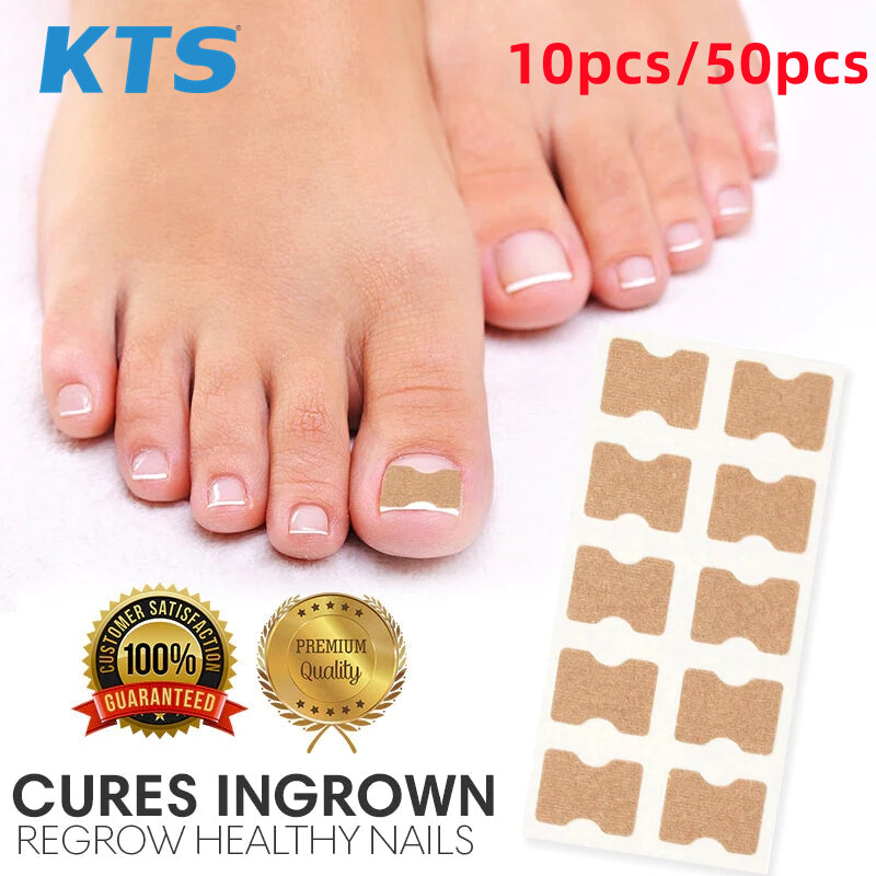 KTS 10/50pcs Ingrown Toenail Corrector Stickers Foot Care Stickers Non ...