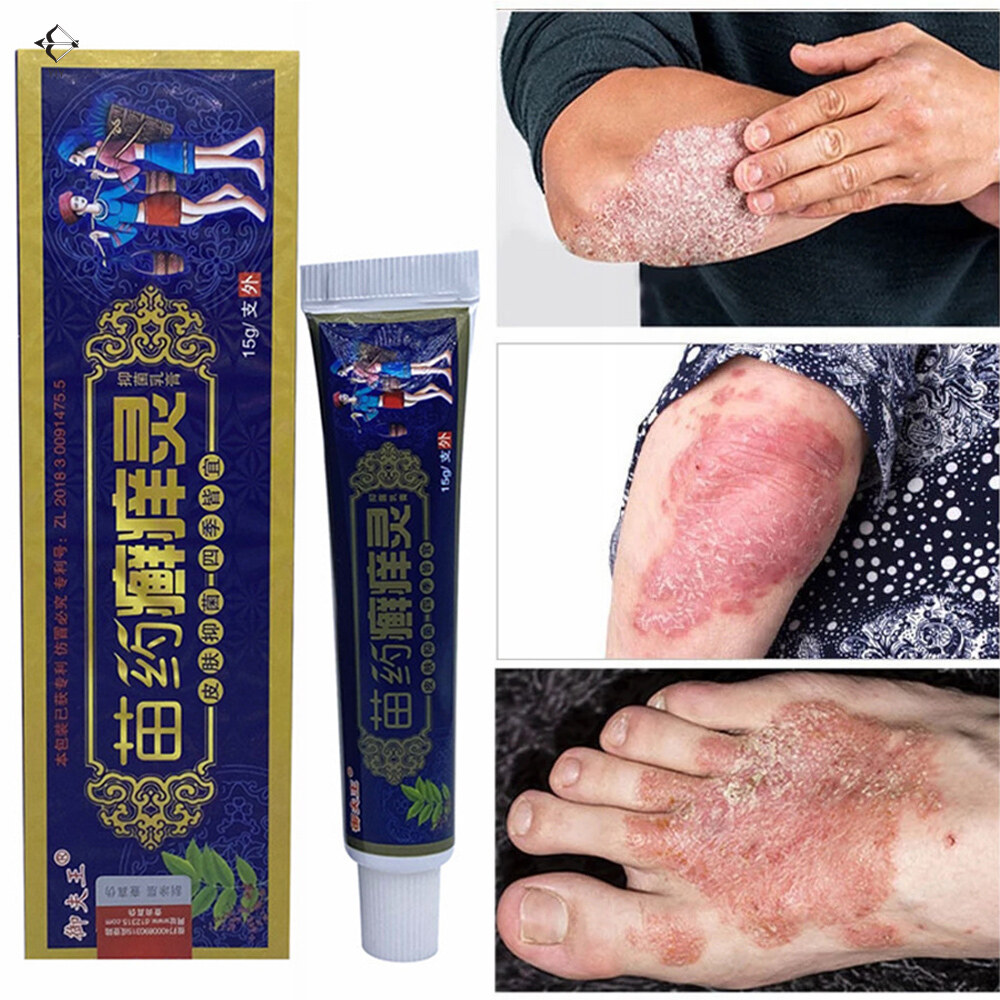 YIY Skin Care Antipruritic Body Beauty Skin Care สมุนไพรธรรมชาติสมุนไพร ...