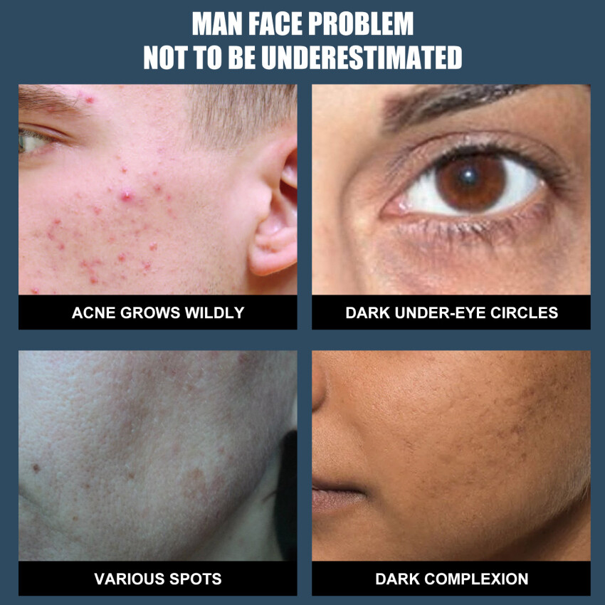 Men 'S Concealer Face Cream Tone Up Cream Invisible Pores Whitening Brightening Moisturizing ...