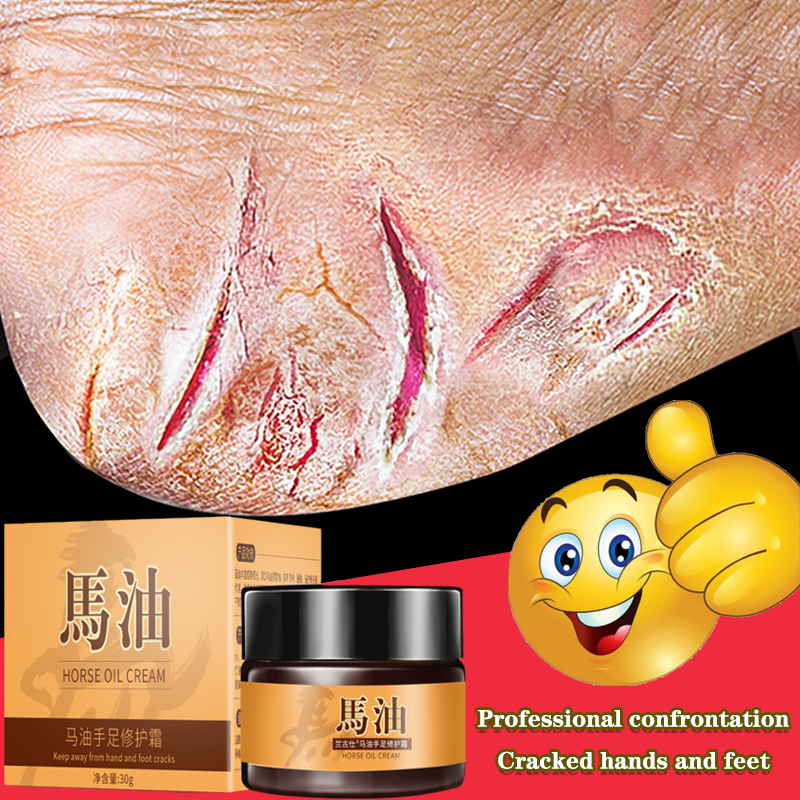 Hand Foot Crack Cream 30g Heel Chapped Peeling Foot and Hand Repair ...