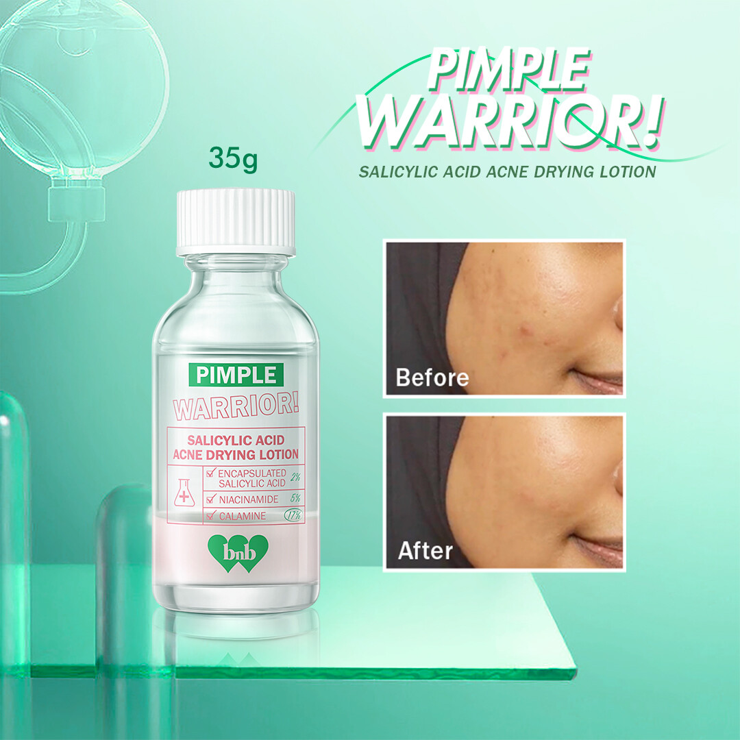 BNB barenbliss Pimple Warrior! Salicylic Acid Acne Drying Lotion ...