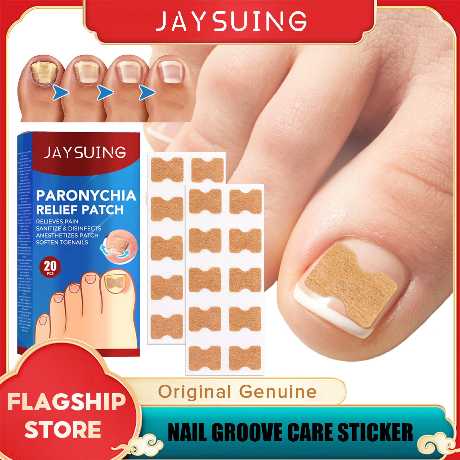 Jaysuing Paronychia Relief Patch Toenail Corrector Patch Paronychia ...