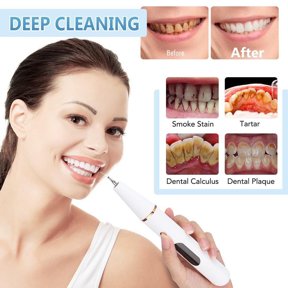 เครื่องขูดฟันVisual Ultrasonic Teeth Cleaner Oral Dental Scaler ...