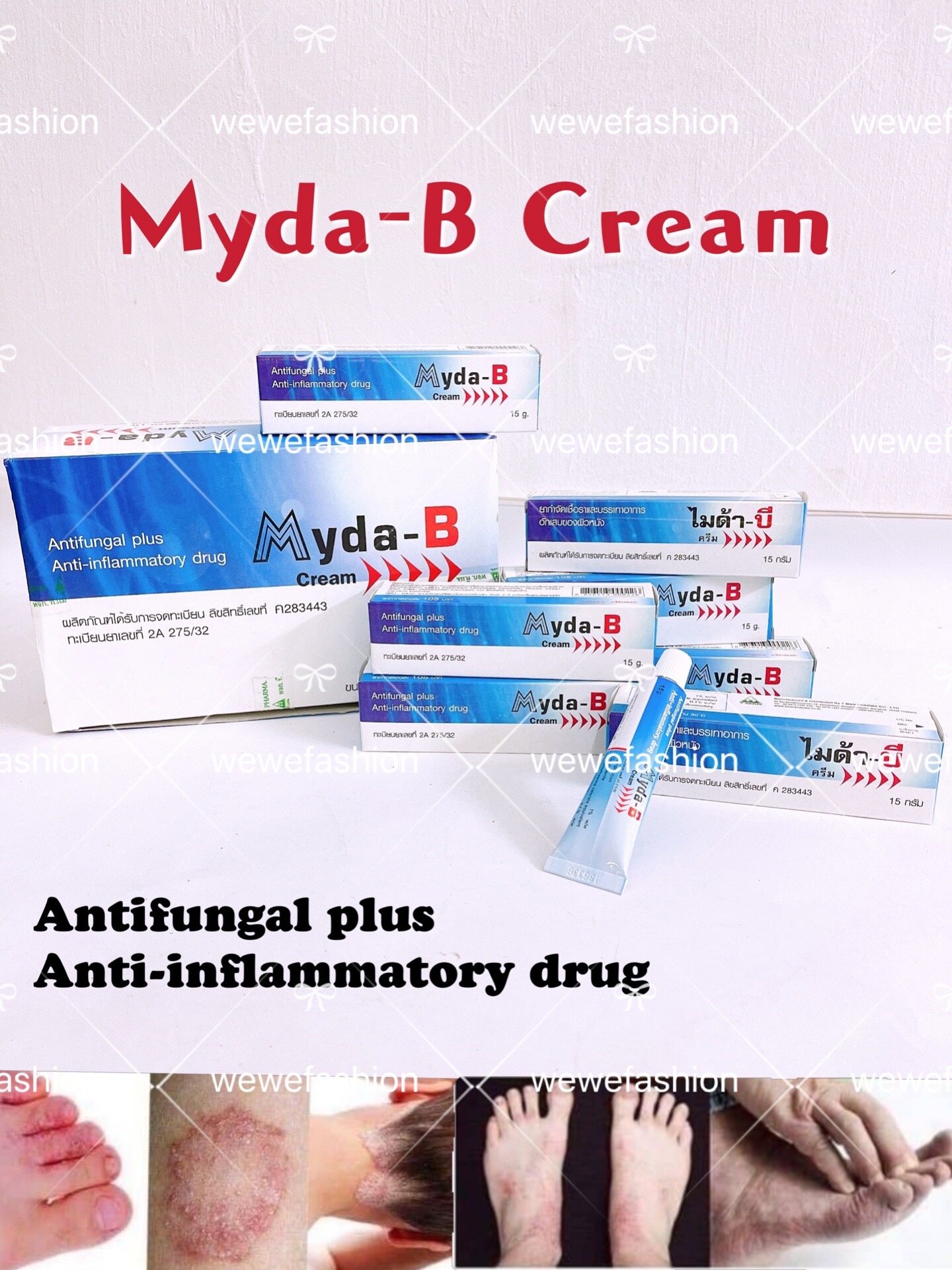 READY STOCK!!!Thailand MYDA-B ANTI-INFLAMMATORY ANTIFUNGAL CREAM 15g 邁拉味药膏 廯膏 香港脚 | Lazada