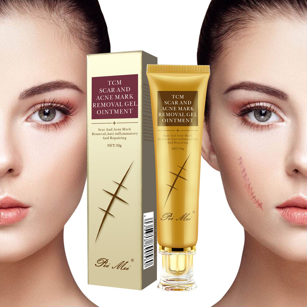 LADES【Ready In Stock】30Ml Women TCM Scar Cream Scald Surgical Scar ...