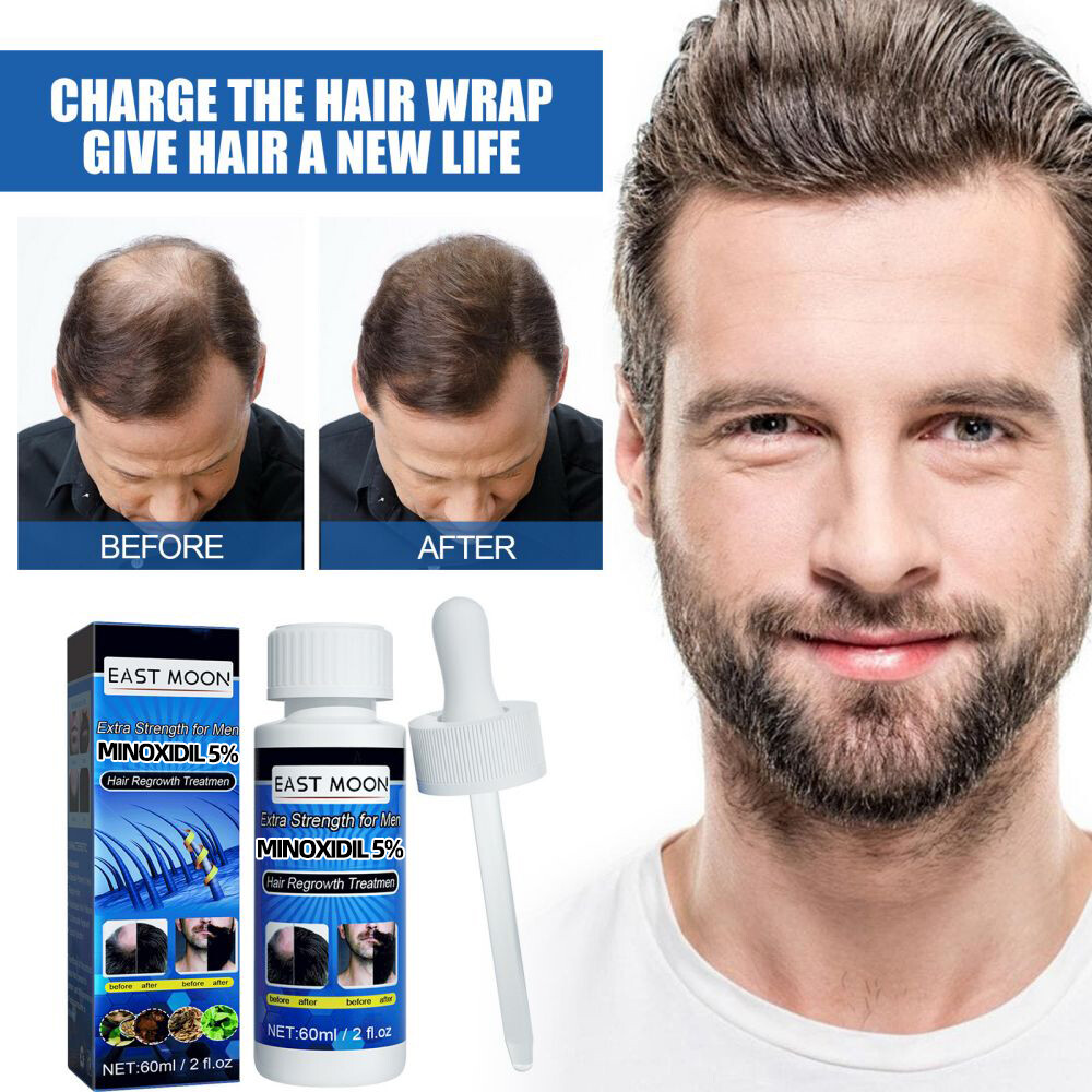 Jaysuing minoxidil hair grower original for men and Women - 60ml hair ...