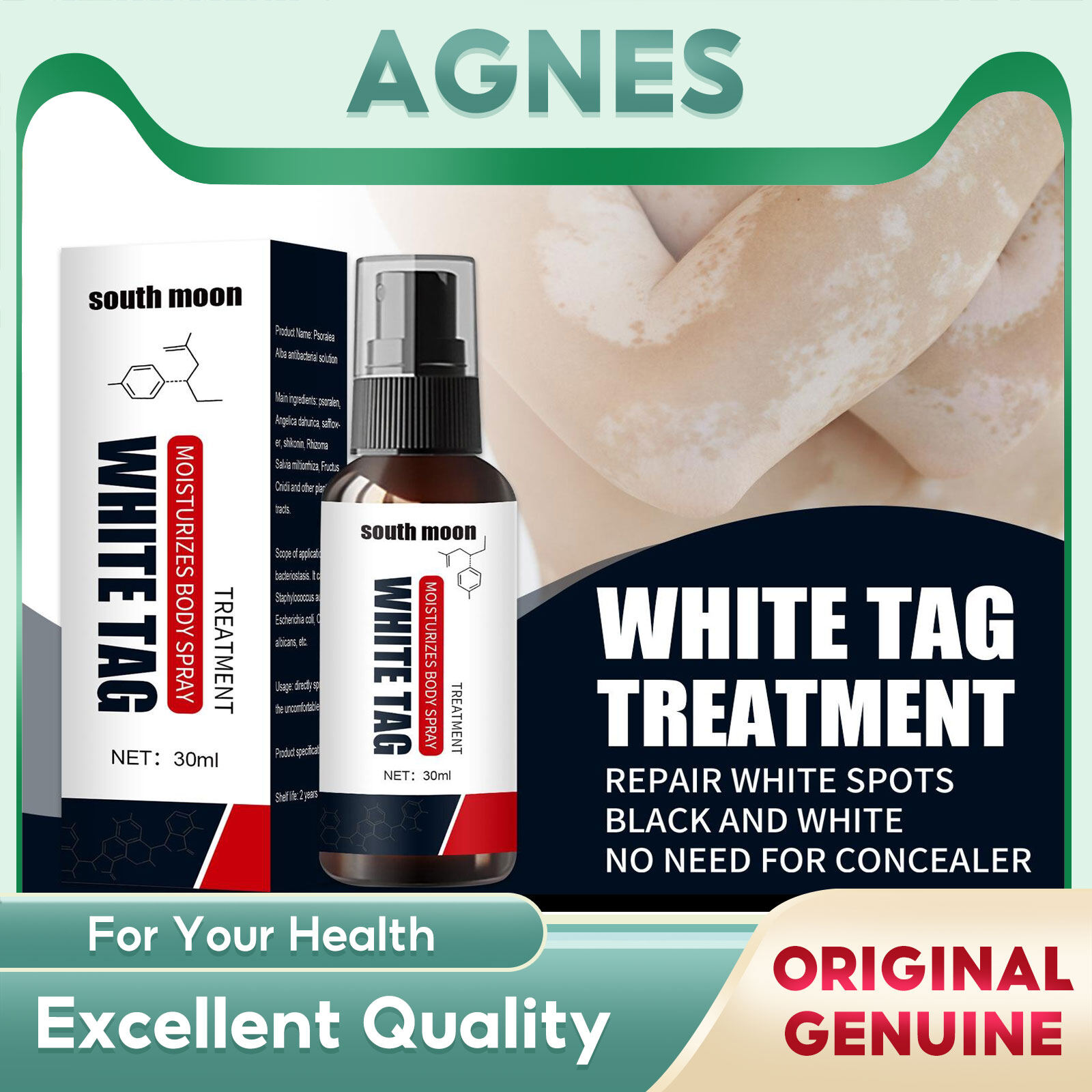 South Moon White Spot Remover Spray Vitiligo Antibacterial Repair ...