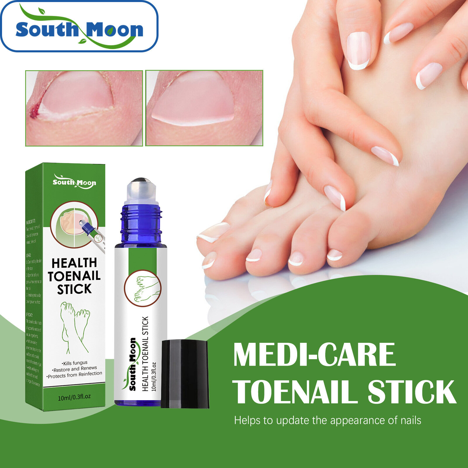 South Moon Health Toenail Stick Fungal Nail Treatment Liquid Toe Fungus ...