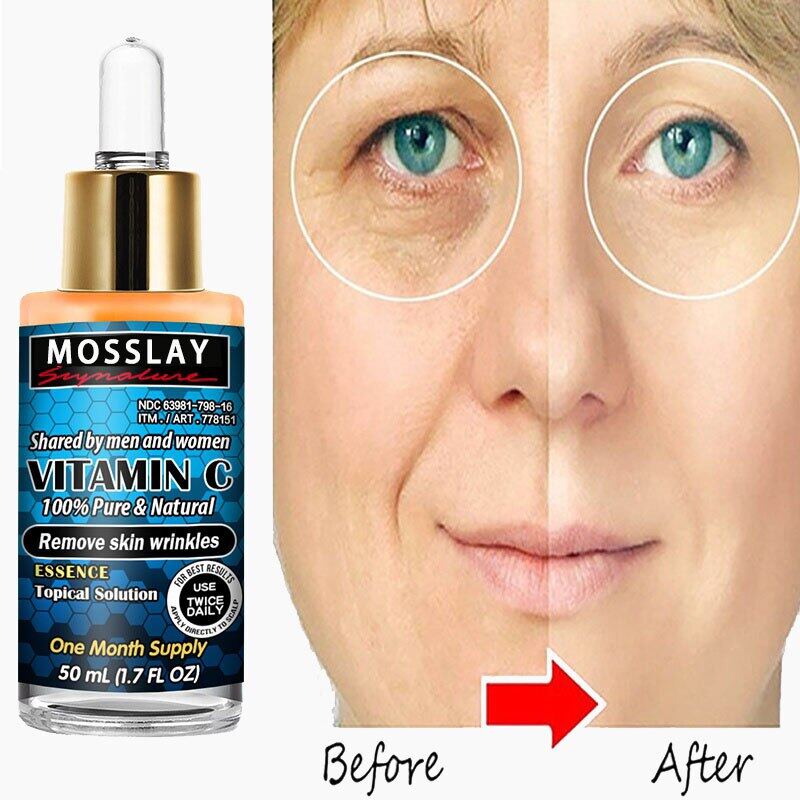 MOSSLAY VitaminC Anti-aging Essence Hyaluronic Acid Shrink Pore Facial ...
