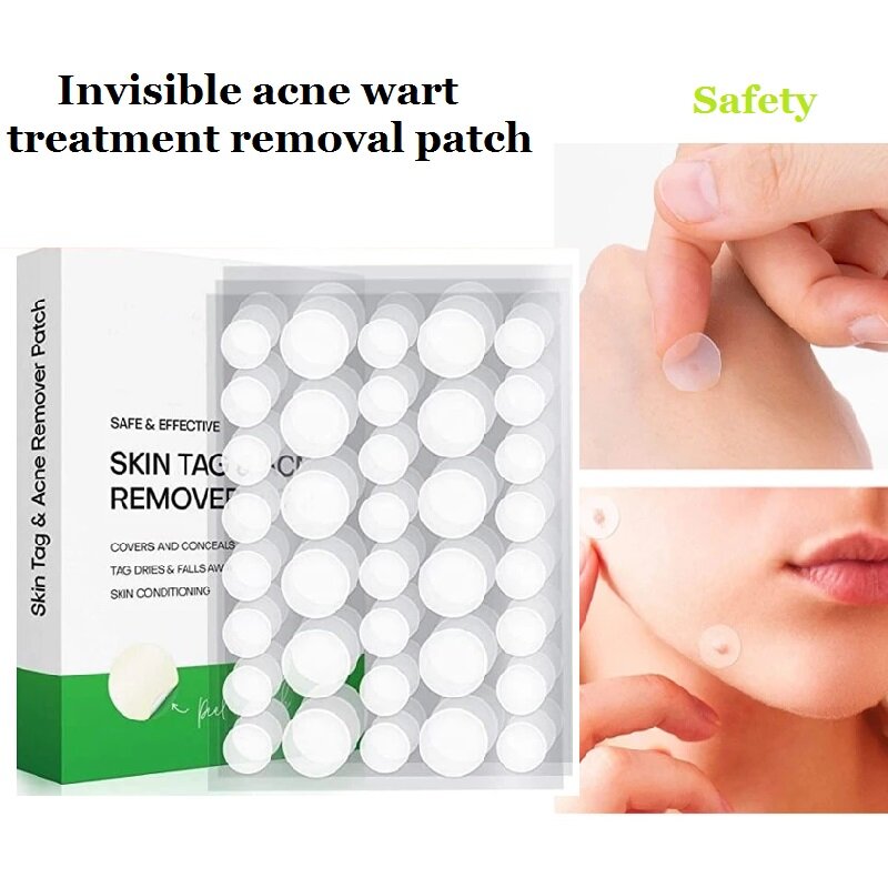 DORISNA Acne And Wart Removal Patch, Wart Treatment, Hydrocolloid Gel ...