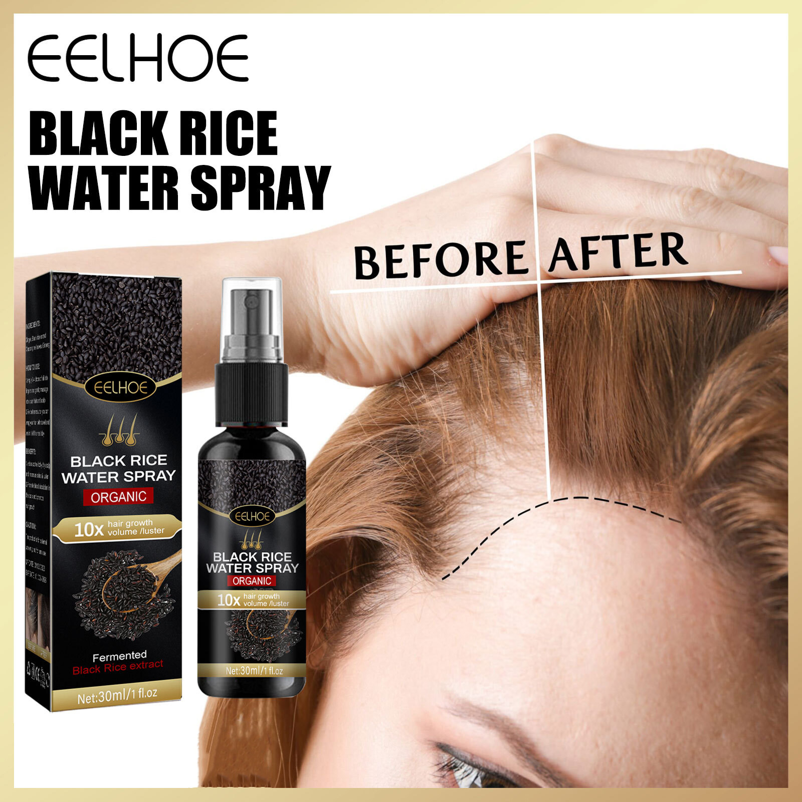 Eelhoe Black Rice Water Hair Growth Essence Anti Hair Loss Anti Hair ...