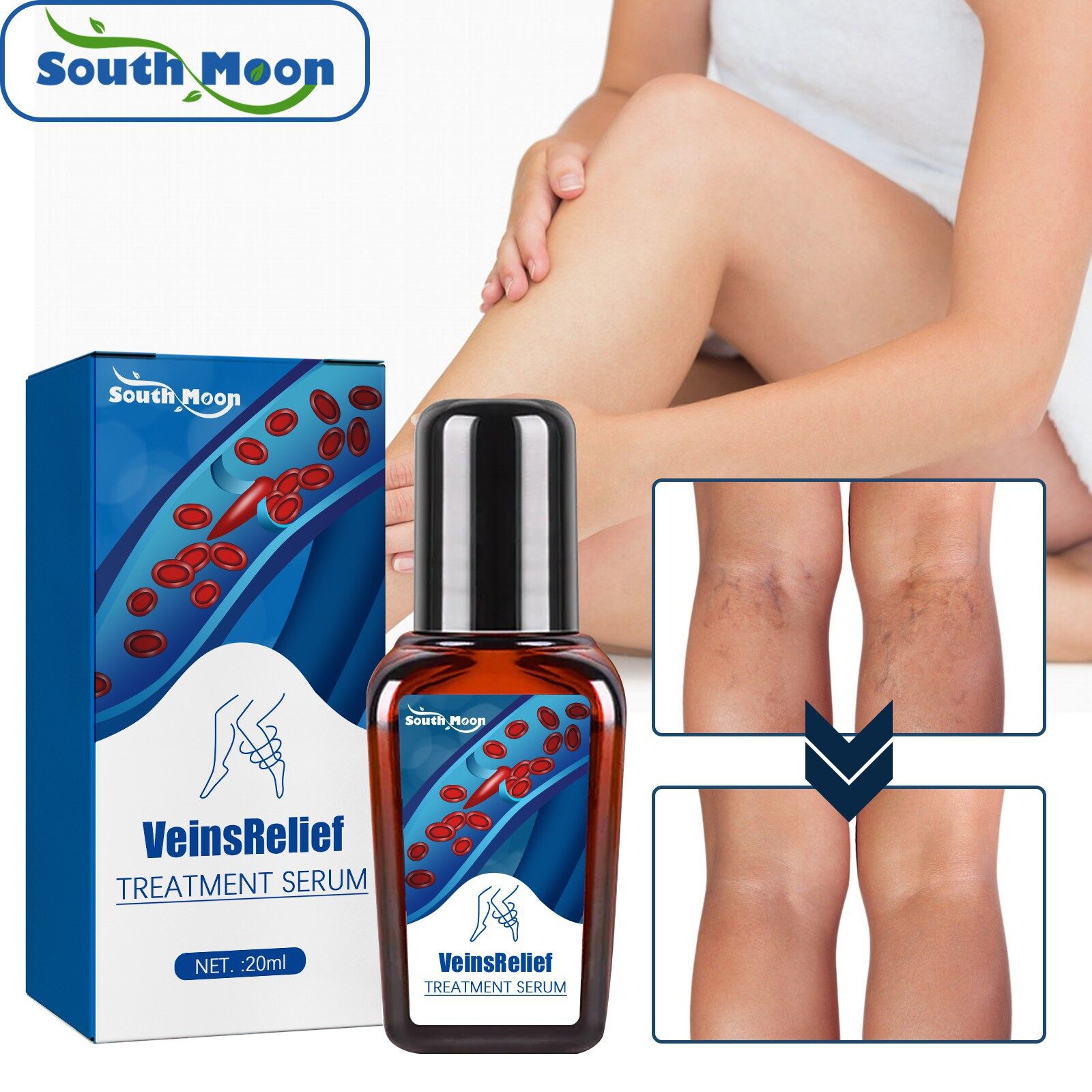 South Moon Veins Relief Treatment Serum Herbal Varicose Veins Relief ...
