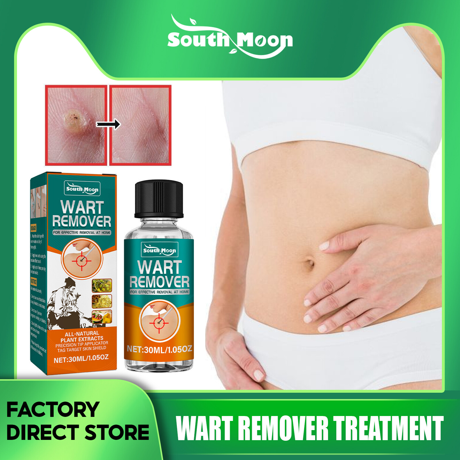 South Moon Wart Remover Liquid Skin Tag Removal Creams Removal ...