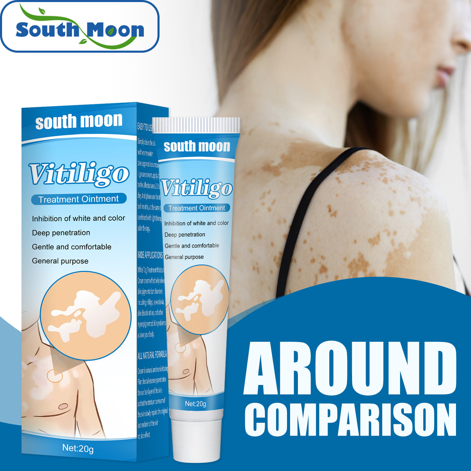 South Moon White Spot Vitiligo Treament Ointment 20g Localized Vitiligo ...