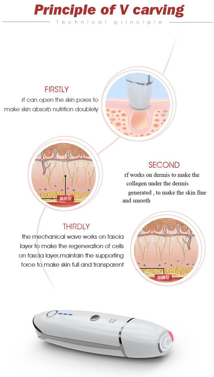 Mini HIFU RF Radar สาย V - Shape Anti - wrinkle กระชับผิว Ultrasound ...